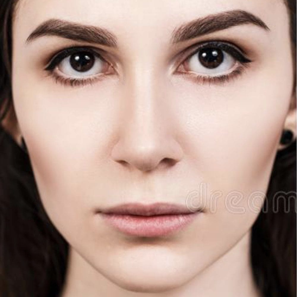 Microneedling - Papillon Skin Clinic