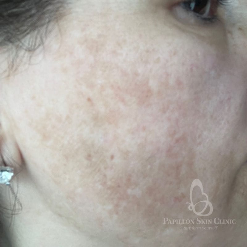 Moonee Ponds Skin Clinic – Premier Melbourne Skin Care